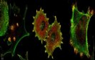 Has the introduction of the '2 week rule' in the UK led to an earlier ...