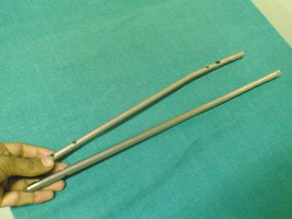 The current status of prophylactic femoral intramedullary nailing for ...