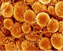 Adipose tissue stem cells in regenerative medicine - ecancer