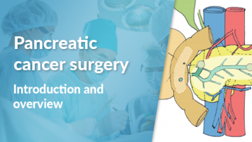 Introduction and overview of pancreatic cancer - ecancer
