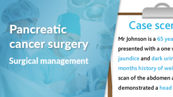 Surgery for pancreatic cancer - ecancer