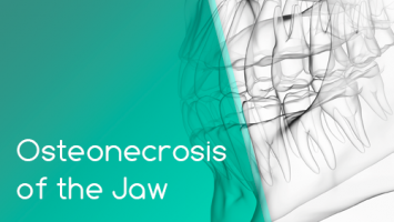 Osteonecrosis of the Jaw - ecancer