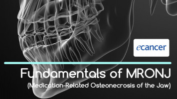Fundamentals of MRONJ (Medication-Related Osteonecrosis of the Jaw ...