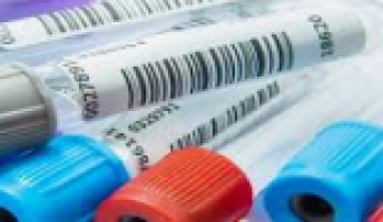 Identifying the main barriers for participation in a population-based ...