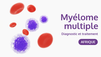 Myélome multiple - Diagnostic et traitement (Afrique) - ecancer