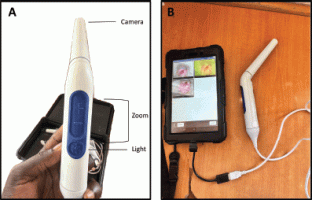 Feasibility of incorporating the Pocket colposcope into nurse-led ...