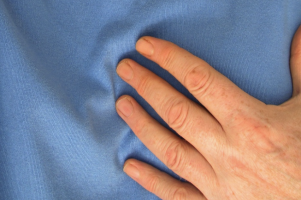 Los pacientes con hematopoyesis clonal tienen un mayor riesgo de ...